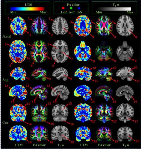 Group Average Ltm Images Reconstructed From Participants