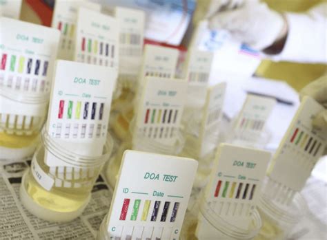 √ Prosedur And Biaya Tes Narkoba Di Klinik Prodia 2023 Harga Biaya