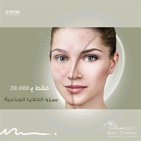 Alia Nasser On Linkedin تصميمي جرافيك مصممجرافيك Graphicdesigner