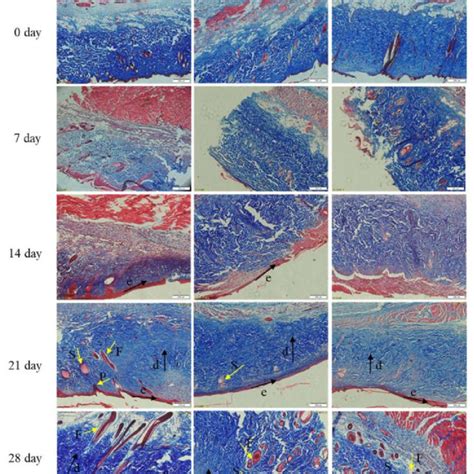 H And E Stained Histologic Sections Of Burn Wounds At Various Times