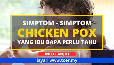 3 Fasa Chicken Pox Simptom Punca Risiko Komplikasi And Rawatan Tcermy