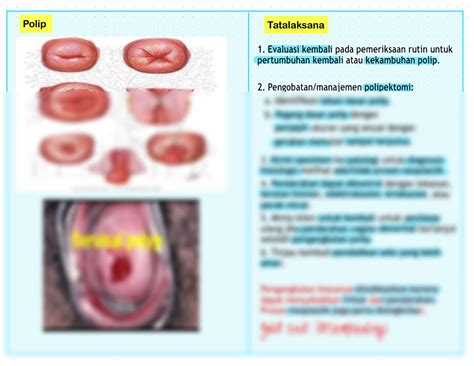 SOLUTION Benign Tumor Of Genitalia Studypool