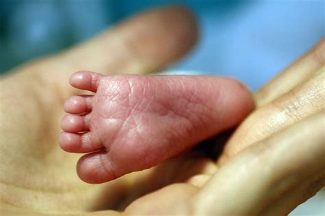 Anomalia Genética Da Fibrose Quística Afeta 7 Milhões De Pessoas