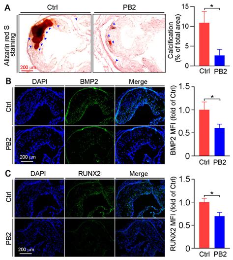 Procyanidin B2 Reduces Vascular Calcification Through Inactivation Of
