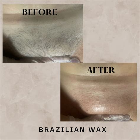 Before And After Brazilian Wax