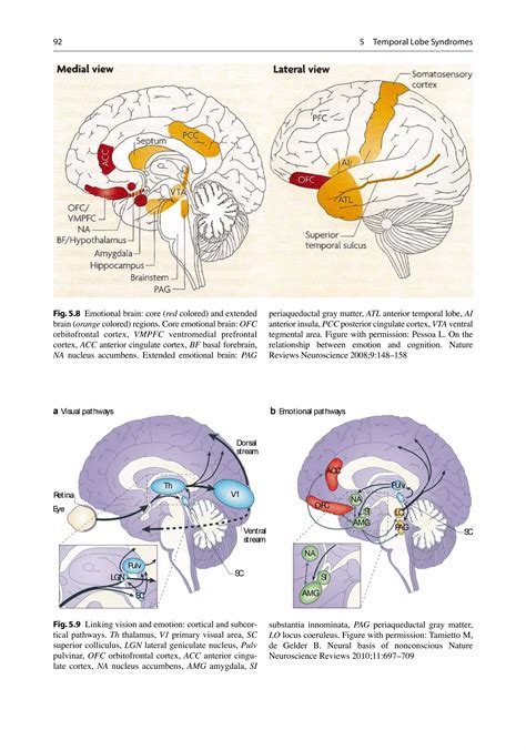 Temporal Lobe Syndrome Pdf