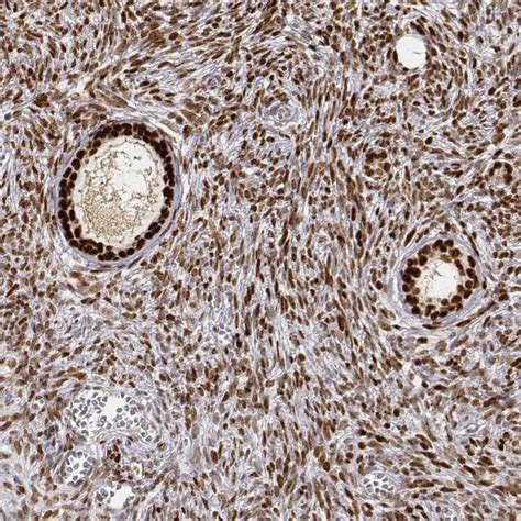 Invitrogen Phf6 Polyclonal Antibody 100 μl Unconjugatedantibodies