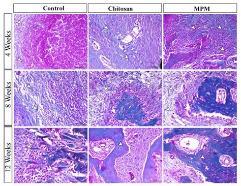 Photomicrographs Of Various Trichrome Stained Bone Sections From The