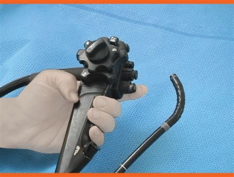 Upper Endoscopy Patient Information From Sages