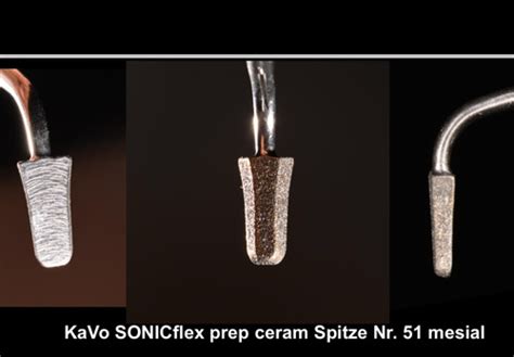 Sonic Sys Karteikarten Quizlet