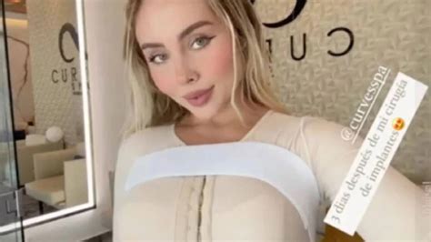 Maya Nazor Presumió Cirugías Y Recibió Críticas “implantes Y Lipo