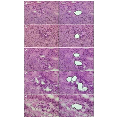 The Expressions Of Ck7 And E Cadherin In Hpcs A F Cholangiocytes In