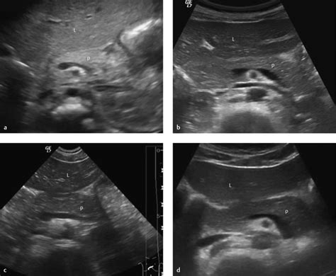 12 Pancreas Radiology Key