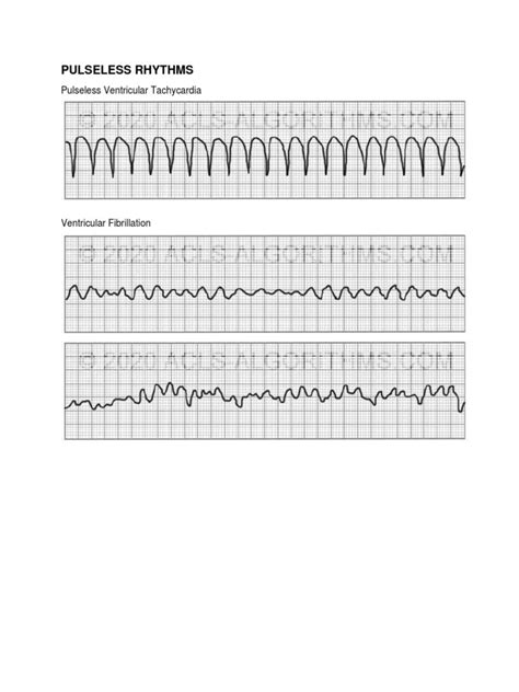 Pulseless Rhythms Pdf Travel Art