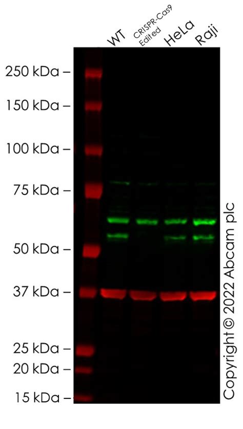 Results For Beclin 1 Abcam Antibodies Proteins Kits