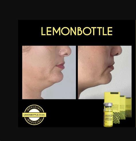 Lemon Bottle Solution Lipolysis For Face And Body 10ml X 5 Lipolysis