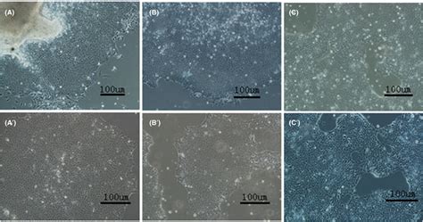 Morphology Of Cv‐ipscs A The Morphology Of Cv‐ipscs Before