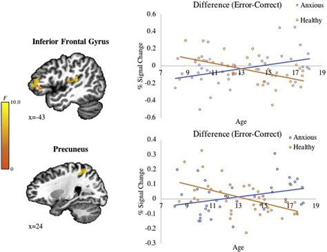 Psychosexual Dysfunction With Inhibited Sexual Excitement Semantic