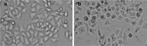 Morphology Of Human Breast Cancer Cells Mcf 7 A Control B Treatment