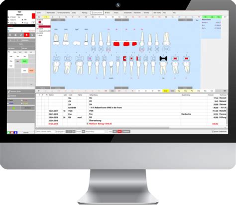 Softdent Erfolg In Der Praxis Softdent Erfolg In Der Praxis