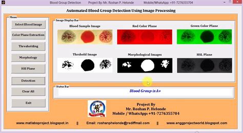Matlab Code For Blood Group Detection And Classification Using Image Processing Full Project