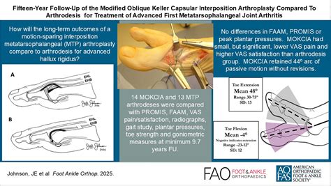 Fifteen Year Follow Up Of The Modified Oblique Keller Capsular