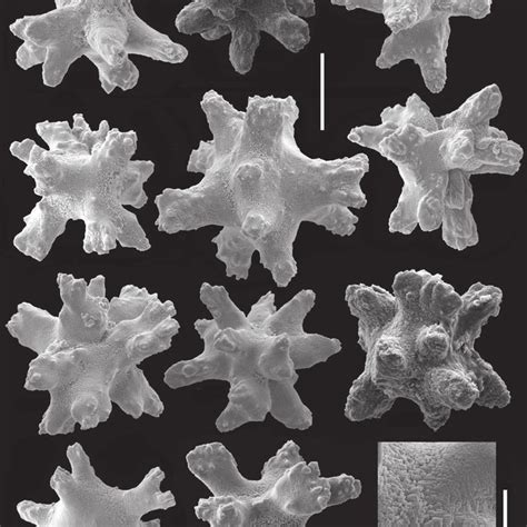 Gersemia Lambi Sp N Scanning Electron Micrographs Of Polyp Sclerites