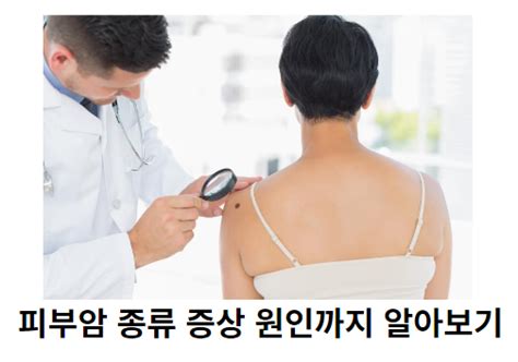 피부암 종류 증상 원인까지 알아보기