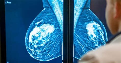 Understanding Mammograms A Vital Tool In Breast Health Mypressportal Free Press Releases