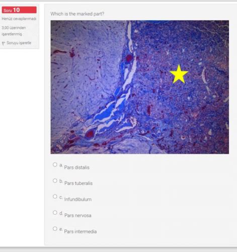 Histology Pineal And Pituitary Gland Flashcards Quizlet