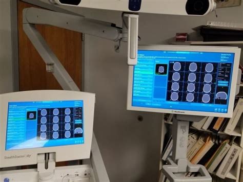 Surgical Navigation System Medtronic S7 Set Up For Spine Trauma ENT Cranial With