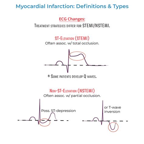 Usmle Comlex Step 1 Glossary Usmlecomlex 1 Myocardial