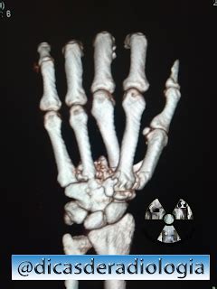 DICAS DE RADIOLOGIA Tudo Sobre Radiologia IMAGENS RADIOLÓGICAS