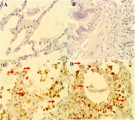 Normal Lung Group A B Showed Negative Reaction With Bcl2 Antibody