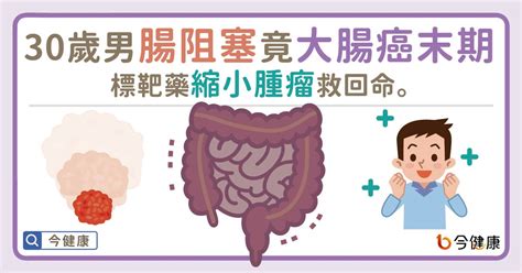 30歲男腸阻塞竟大腸癌末期！標靶藥縮小腫瘤救回命 今健康