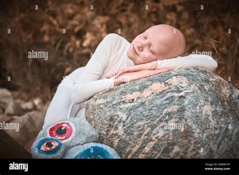 Young Hairless Girl With Alopecia In White Futuristic Costume Sleeping