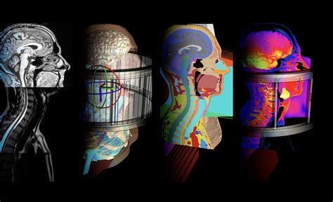 Multiphysics Cae Simulation Platform Wireless Device And Antenna Design
