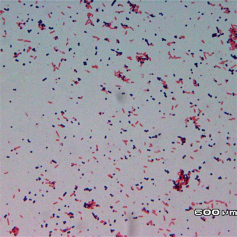 Pdf Pulmonary Infection By Rhodococcus Equi Presenting With Positive