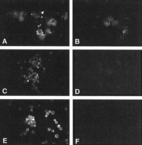 Functional Il 10 Deficiency In The Lung Of Cystic Fibrosis Cftr−−