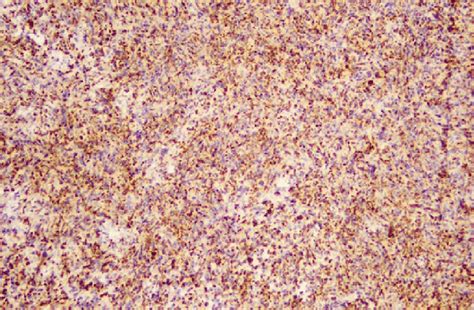 Immunohistochemistry Showing Cd68 Positivity Download Scientific Diagram