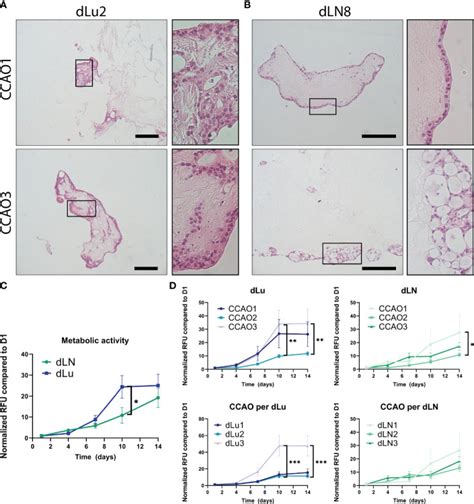 Modelling Metastatic Colonization Of Cholangiocarcinoma Organoids In Decellularized Lung And
