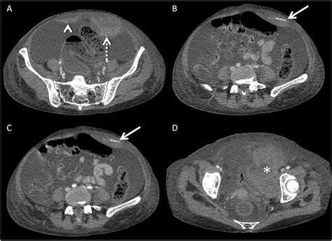 A D Axial Contrast Enhanced Ct Images At Different Levels From The Download Scientific