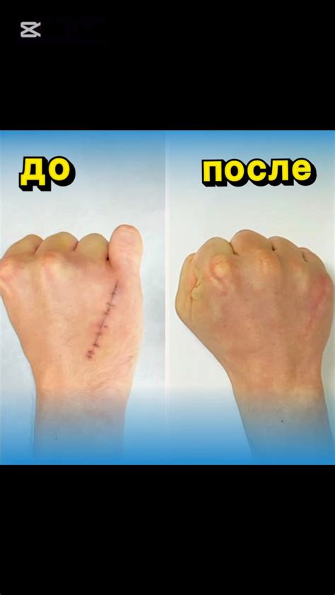 Оңалту орталығы Центр реабилитации Vivita Rehabilitation • Instagram
