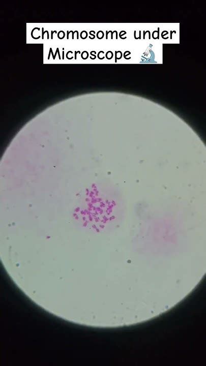 The Structure Of A Chromosome Under A Microscope Chromosome Chromosomal Youtube