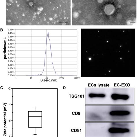 Characterization Of EC EXO A Representative Transmission Electron