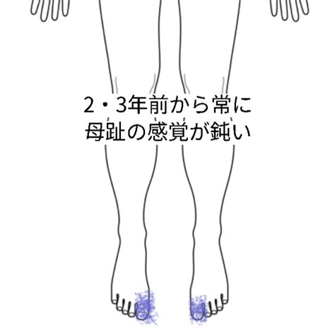 常にお尻から足までシビレて足がこわばる腰痛｜脚・足・足指のしびれ、腰痛のツボ｜ツボネット 鍼灸の症例が検索できるツボ辞典