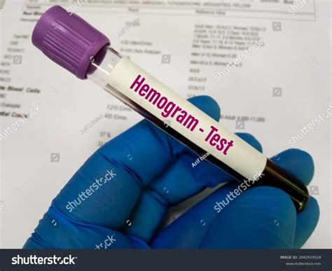 Hemogram 6 Part Diff Thyrocare Aarogyam Centre Diagnostic Centre