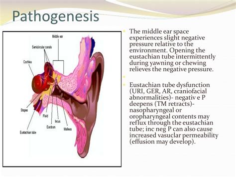 Ppt Otitis Media Powerpoint Presentation Free Download Id5669922