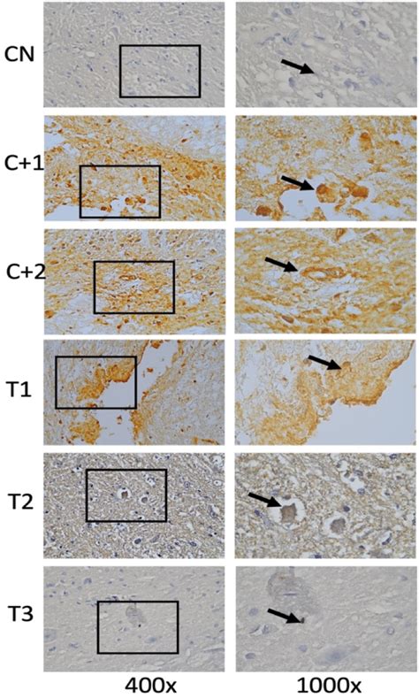 Immunohistochemical Staining With Amyloid Download Scientific Diagram