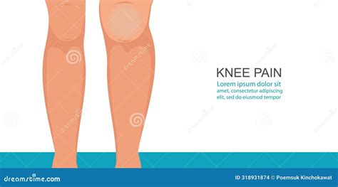 Body People With Leg And Knee Pain Symptoms Stock Vector Illustration